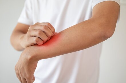 A Brief Guide to Avoiding Skin Infections | Nacach Wax
